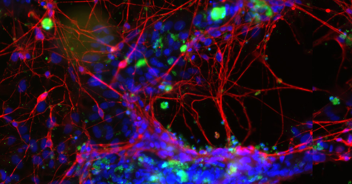 Reshaping Medicines Discovery at Medicines Discovery Catapult