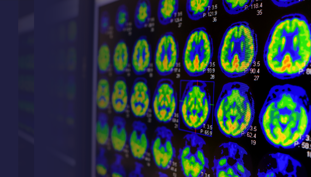 Translational Imaging at Medicines Discovery Catapult